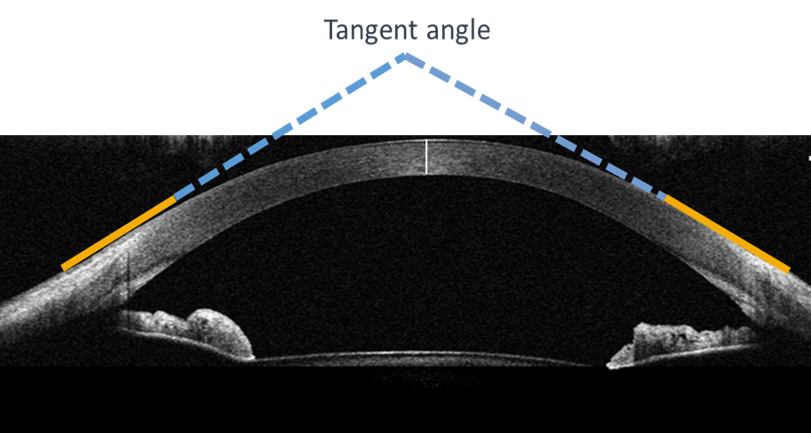 Menicon Z Night | Products | Professional | Menicon